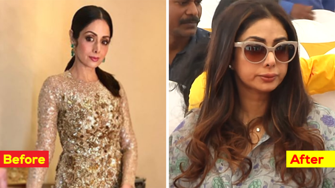 Everyone Seems Convinced That Sridevi's Rumoured Lip-Job Went Horribly ... Everyone Seems Convinced That Sridevi's Rumoured Lip-Job Went Horribly ...